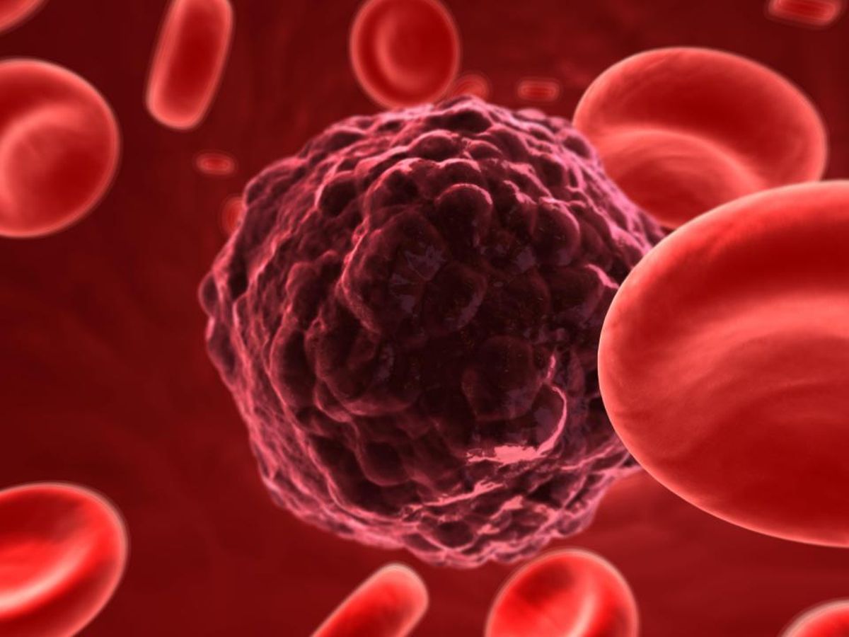 5 facts you need to know about Cancer 5 facts you need to know about Cancer