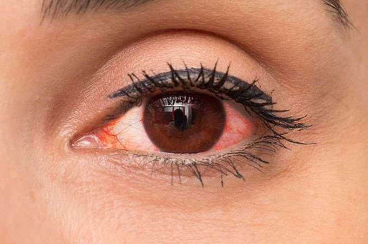 Daily habits that damage your eyesight