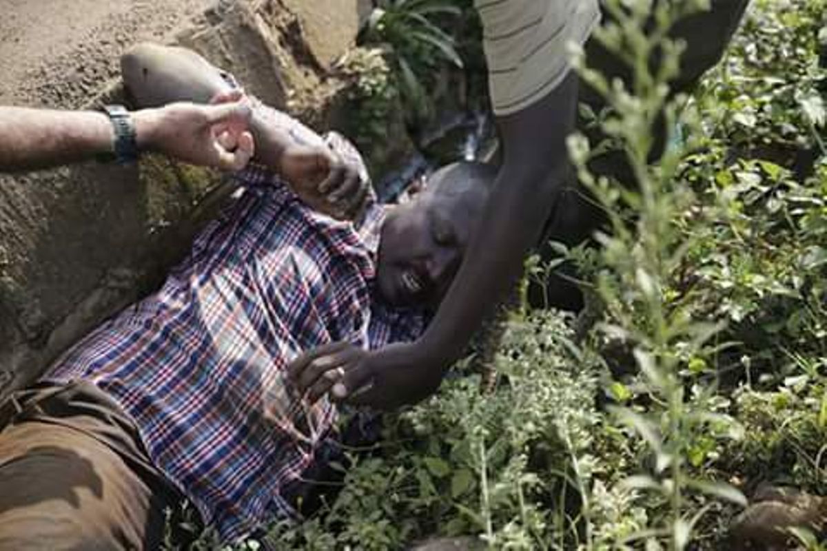 How Kathiani MP broke his leg
