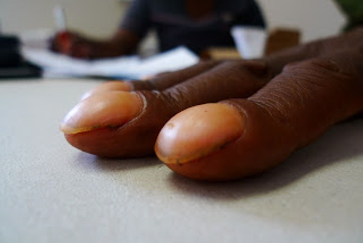 Strange signs that your heart is in bad shape