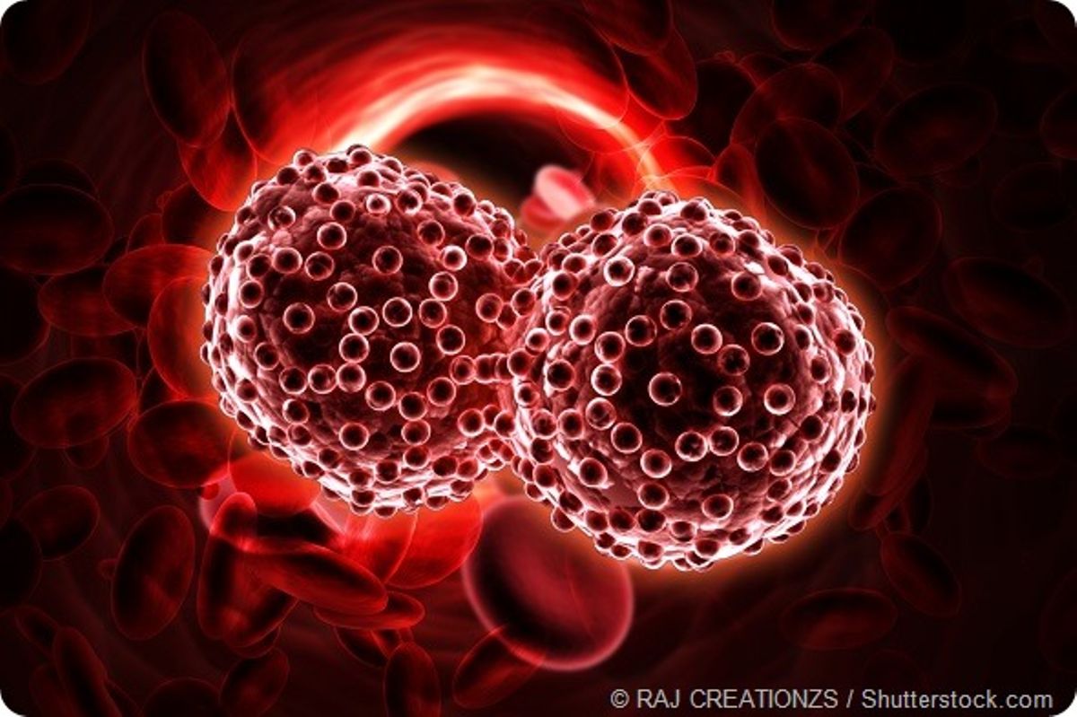 Three types of blood cancer you should be aware of