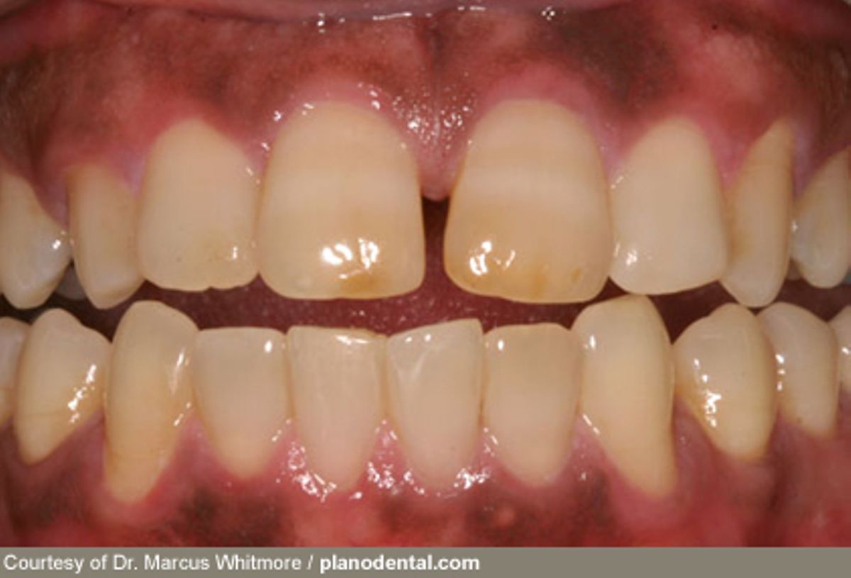 What your teeth say about your health